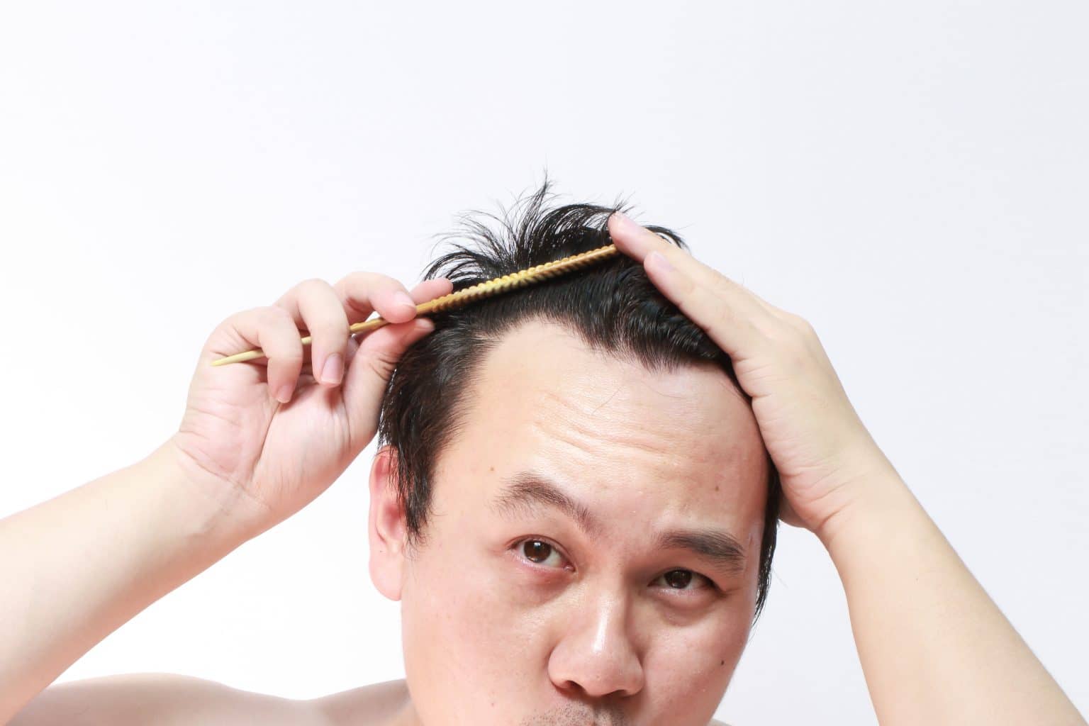 Does An Itchy Scalp Lead To Hair Loss? | TrichoLab