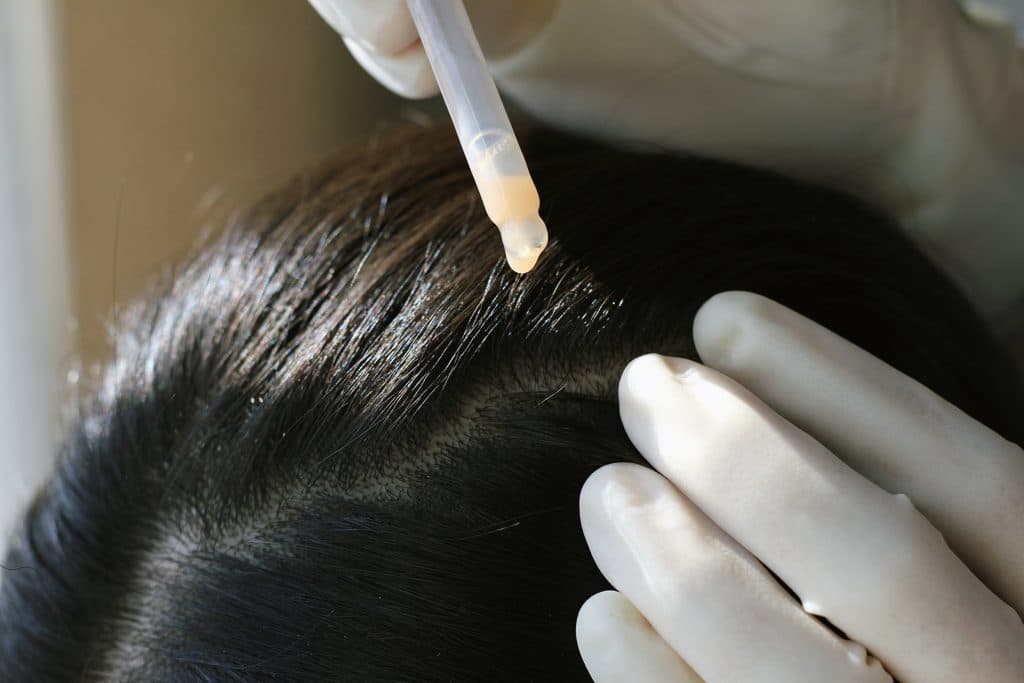 The Ultimate Guide To Dandruff: Causes, Treatments & More